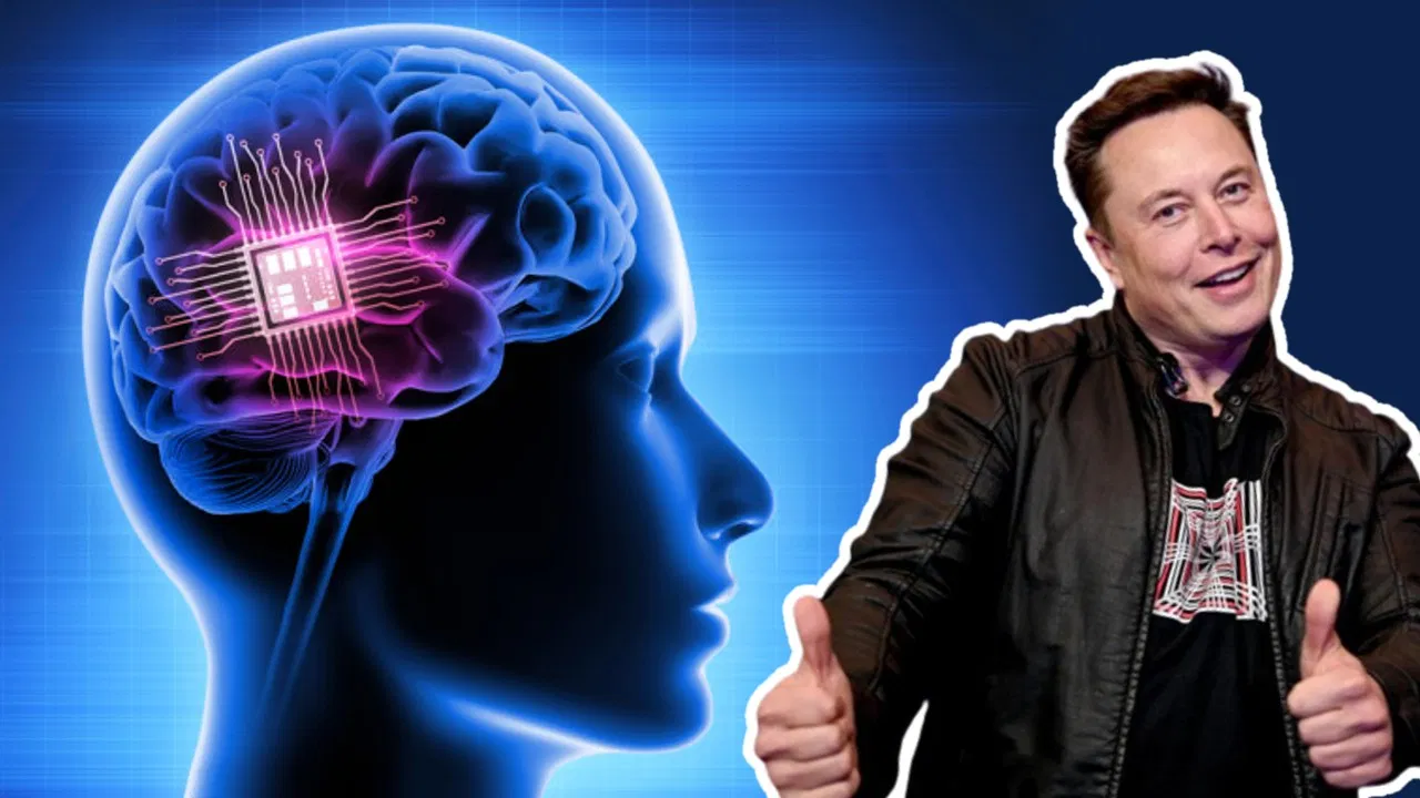 Ελον Μασκ: Πήρε έγκριση για να βάζει «τσιπάκια» σε ανθρώπινους ...
